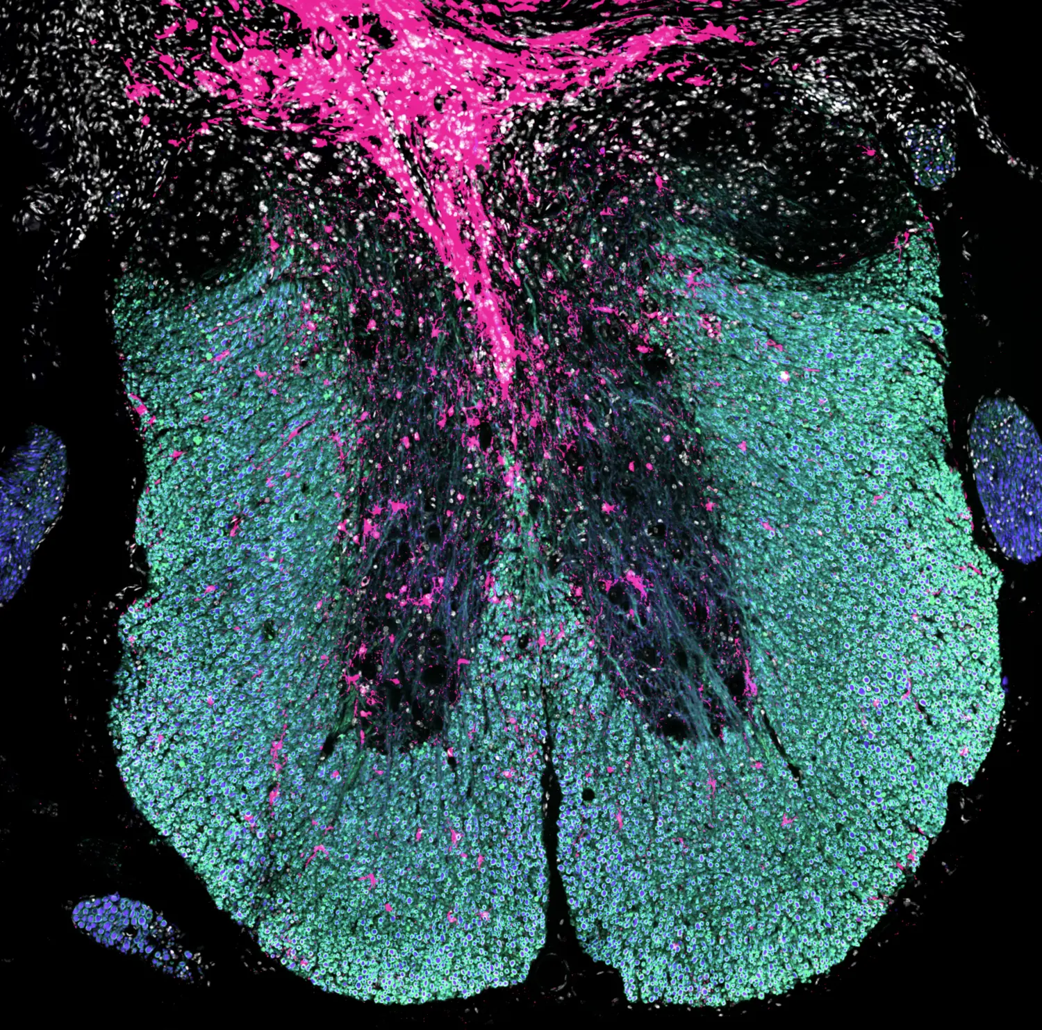 Systems regenerative neurobiology – Enric Llorens Group | Karolinska Institutet